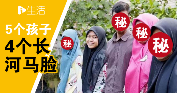 爸爸患怪病 一家生5兄妹4人长出“河马脸”无法治愈！ | 新生活报 - ILifePost爱生活