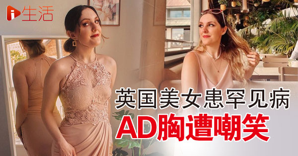 英国美女患罕见病AD胸遭嘲笑 | 新生活报 - ILifePost爱生活