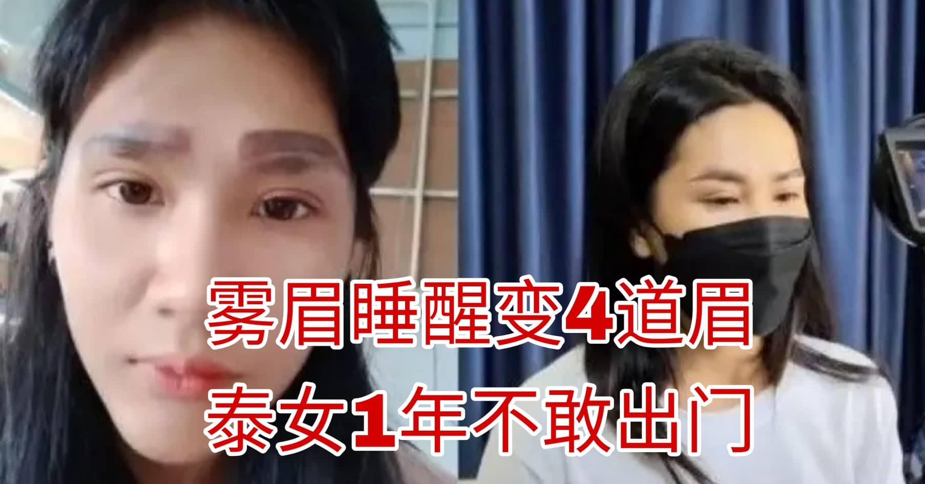 雾眉变4道眉毛泰女子1年不敢出门 | 新生活报 - ILifePost爱生活