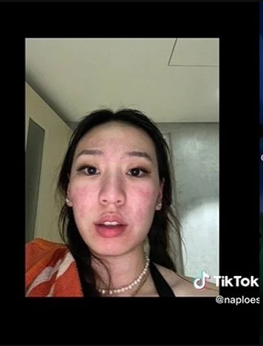 峇淡岛旅游庆生被沙蝇叮女子呼吸困难送院 | 新生活报 - ILifePost爱生活