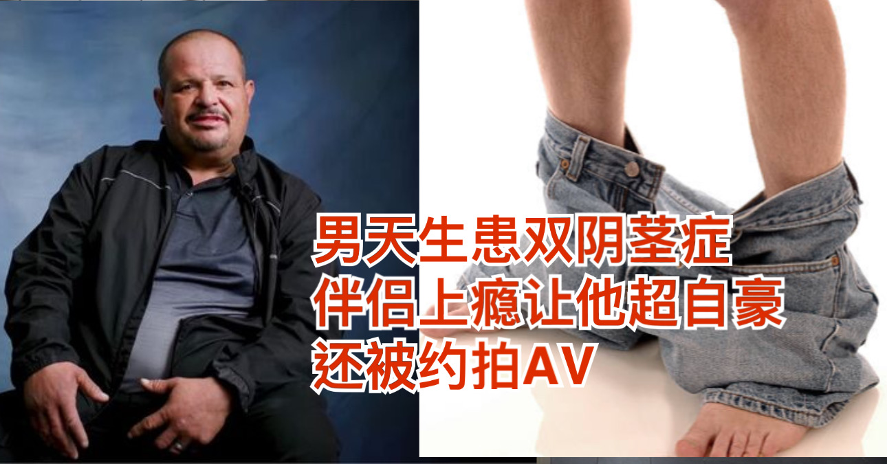男天生患双阴茎症 伴侣上瘾让他超自豪 还被约拍AV | 新生活报 - ILifePost爱生活