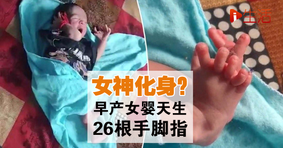 女神化身？早产女婴天生“26根手脚指” | 新生活报 - ILifePost爱生活