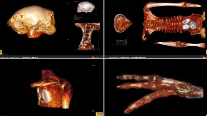 墨西哥公开“千年外星人尸”！腹部藏3颗卵未知DNA沦风干化石 | 新生活报 - ILifePost爱生活