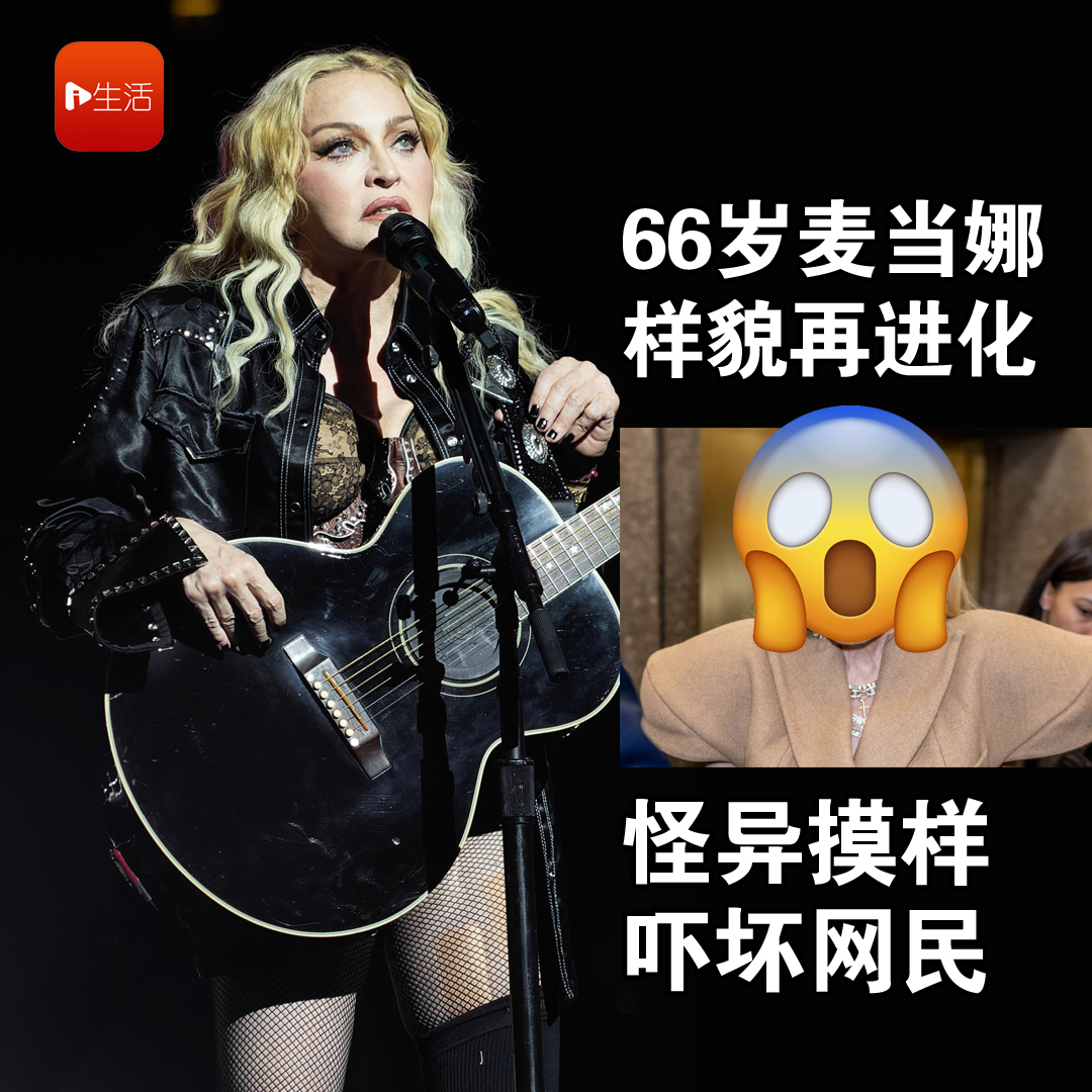 66岁麦当娜样貌不断进化 颧骨“起角”嘴唇过度丰满吓坏网民 | 新生活报 - ILifePost爱生活