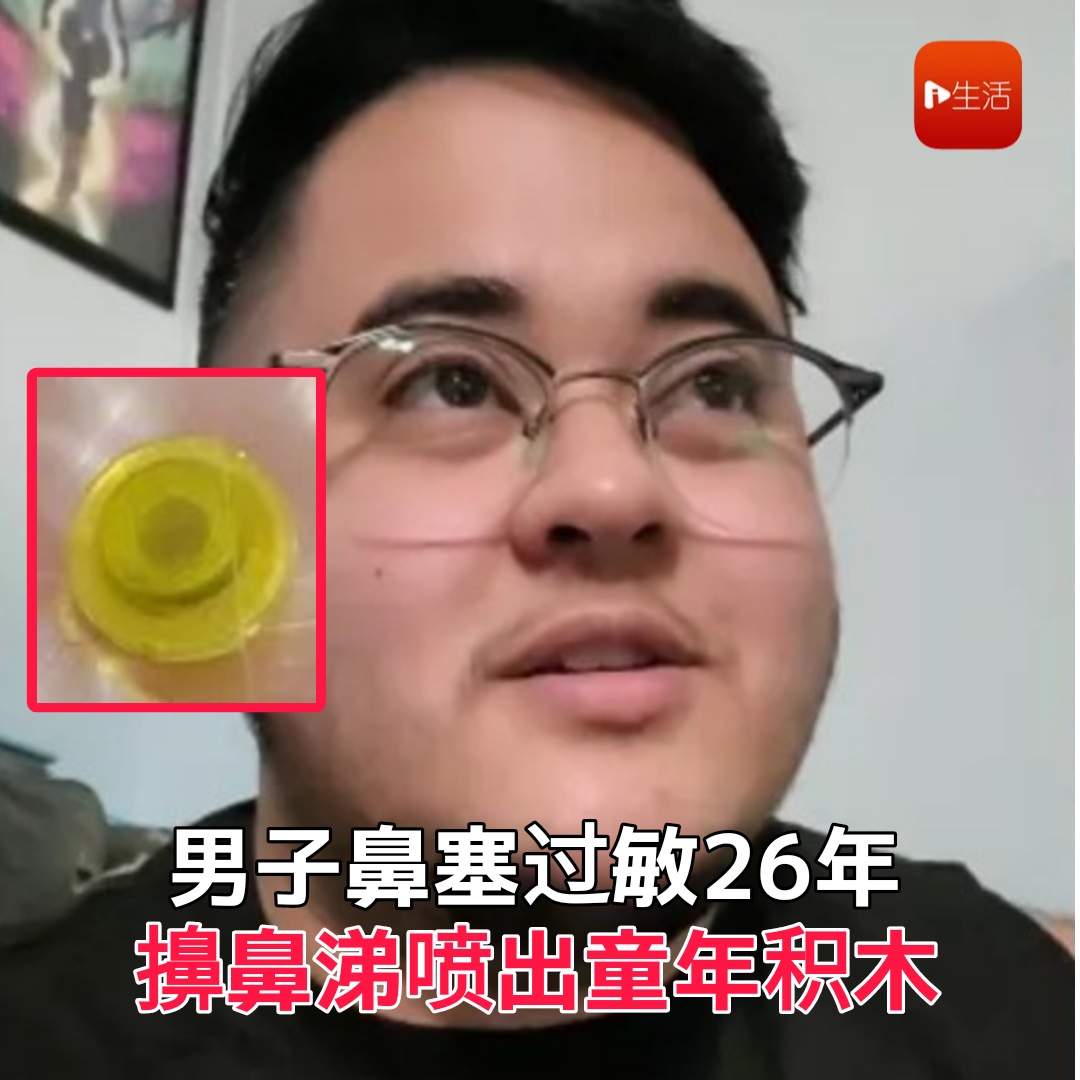 男子鼻塞过敏26年 擤鼻涕喷出童年积木 | 新生活报 - ILifePost爱生活
