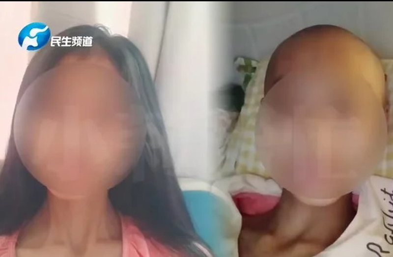 每月来2次月经竟是癌末 13岁女：想留长发陪爸妈 | 新生活报 - ILifePost爱生活