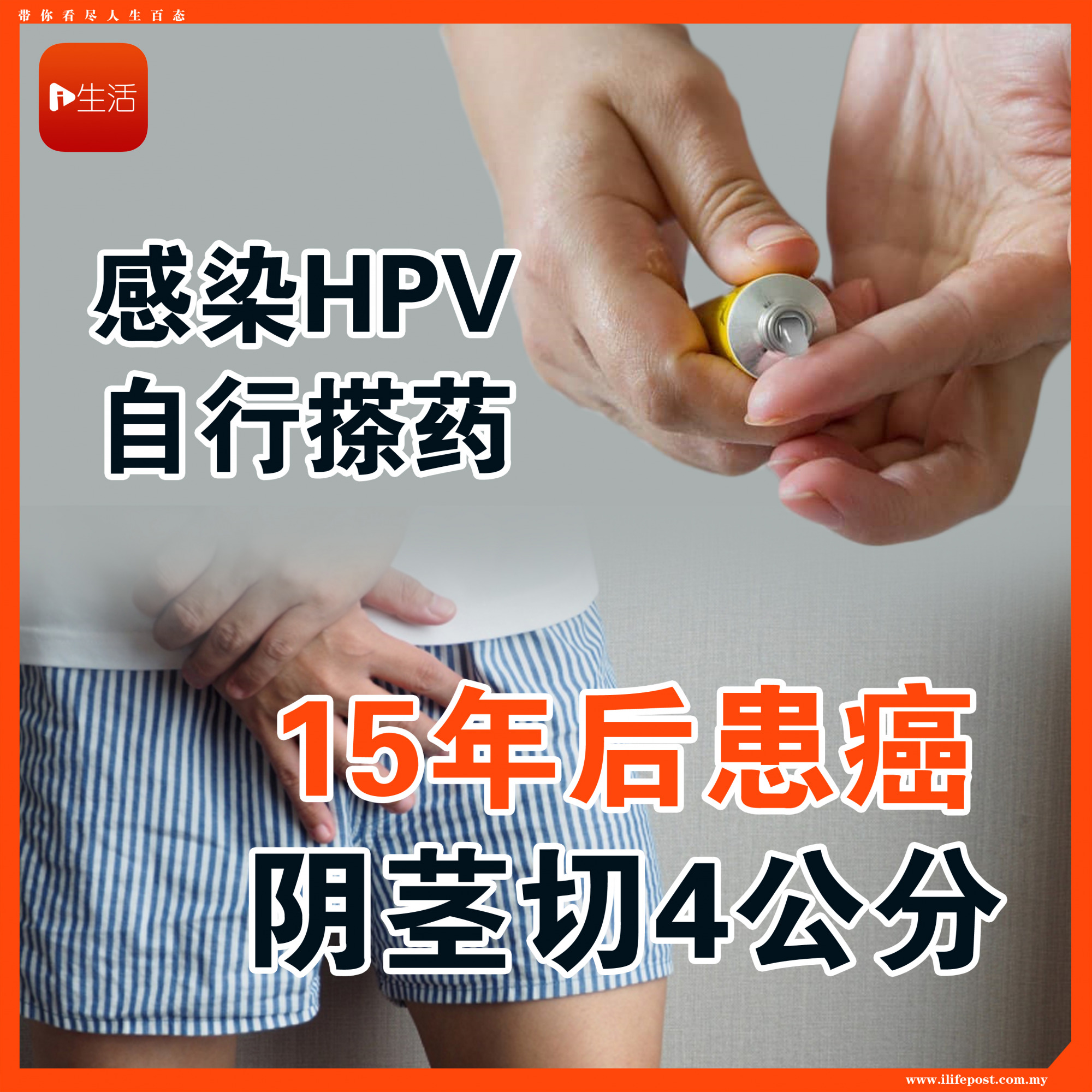 感染HPV自行搽药 15年后患癌阴茎切4公分 | 新生活报 - ILifePost爱生活